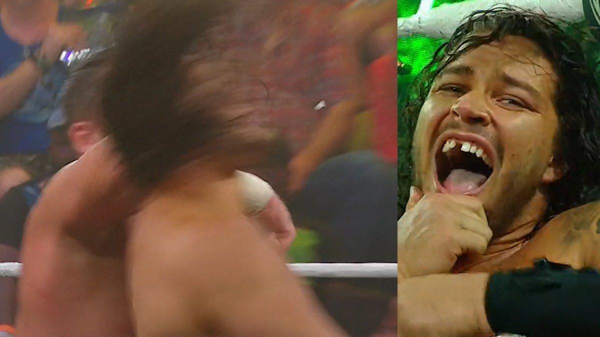 WWE Star Loses Tooth During Match - WrestleTalk
