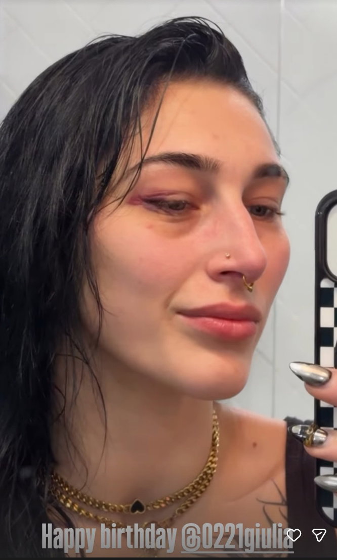 Rhea Ripley WWE Injury Update After SmackDown - WrestleTalk